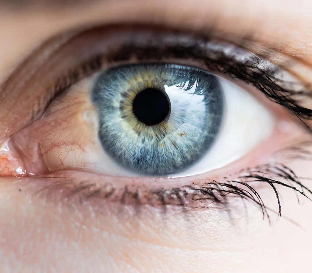 Pterygium Treatment in Fort Worth & Colleyville, TX | Azure Eye Center
